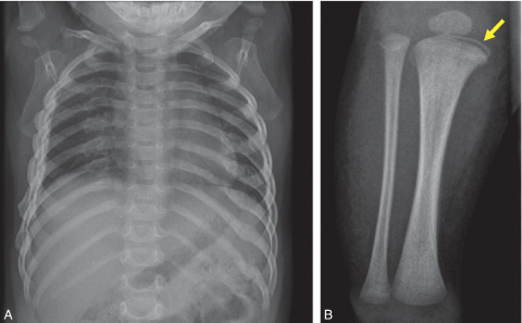 Maltraitance | www.pedia-univ.fr