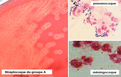 Spécificités infectiologiques pédiatriques | Collège nationale des ...